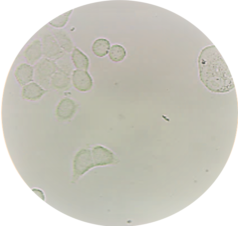 Rarecells - ISET : Live and fixed circulating tumor cells for research