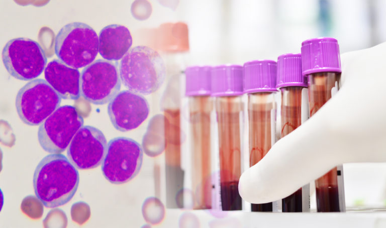 Rarecells - ISET Technology and circulating tumor cells liquid biopsy